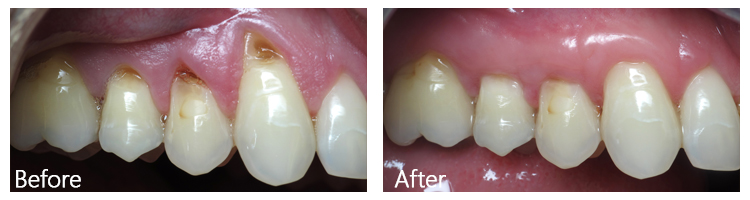 Polk Periodontics Dental Implant Center